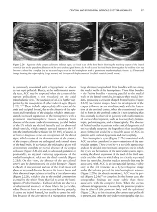 Paladini Us Of Congenital Fetal Anomalies 1st Edition | PDF