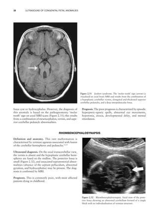 Paladini Us Of Congenital Fetal Anomalies 1st Edition | PDF
