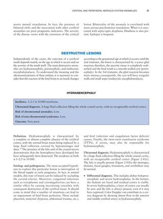 Paladini Us Of Congenital Fetal Anomalies 1st Edition | PDF