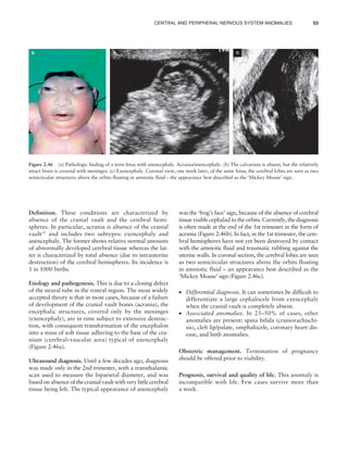 Paladini Us Of Congenital Fetal Anomalies 1st Edition | PDF