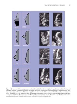 Paladini Us Of Congenital Fetal Anomalies 1st Edition | PDF