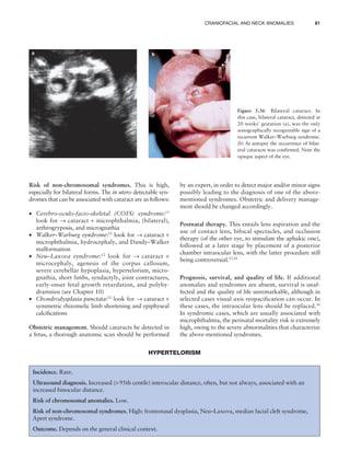 Paladini Us Of Congenital Fetal Anomalies 1st Edition | PDF
