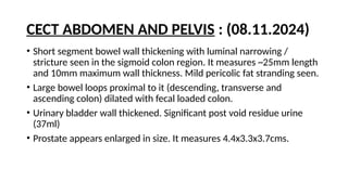 Palanivel ca rectum-sigmoid - a recent case with unique presentation ...