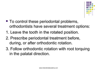 Palatal and buccal root torquing springs | PPT