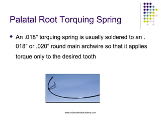 Palatal and buccal root torquing springs | PPT