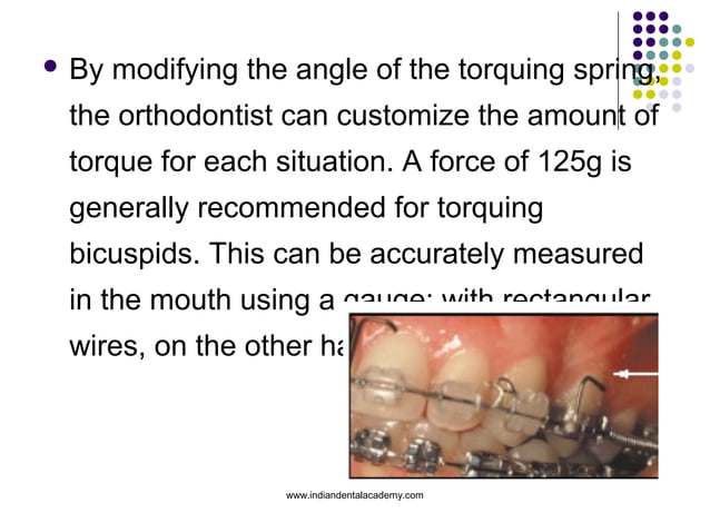 Palatal and buccal root torquing springs | PPT