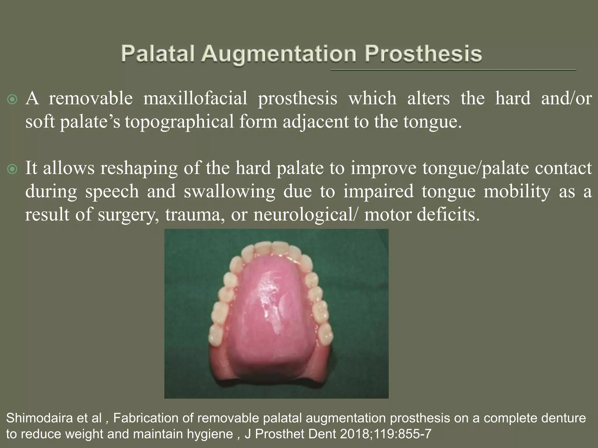 Removable Palatal Augmentation Prosthesis | PPTX