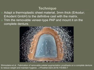 Removable Palatal Augmentation Prosthesis | PPTX