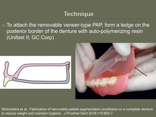 Removable Palatal Augmentation Prosthesis | PPTX