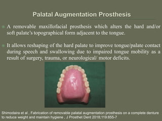 Removable Palatal Augmentation Prosthesis | PPTX