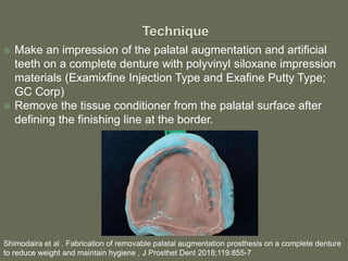 Removable Palatal Augmentation Prosthesis | PPTX