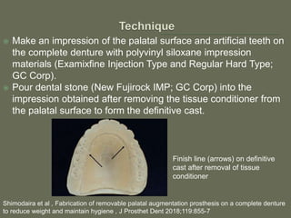 Removable Palatal Augmentation Prosthesis | PPTX