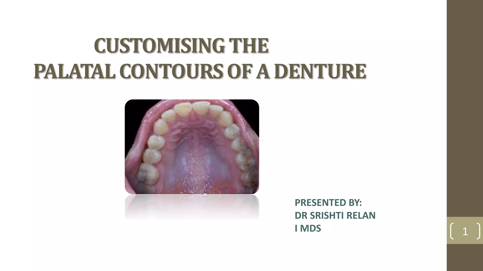 Palatal contours of denture | PPTX