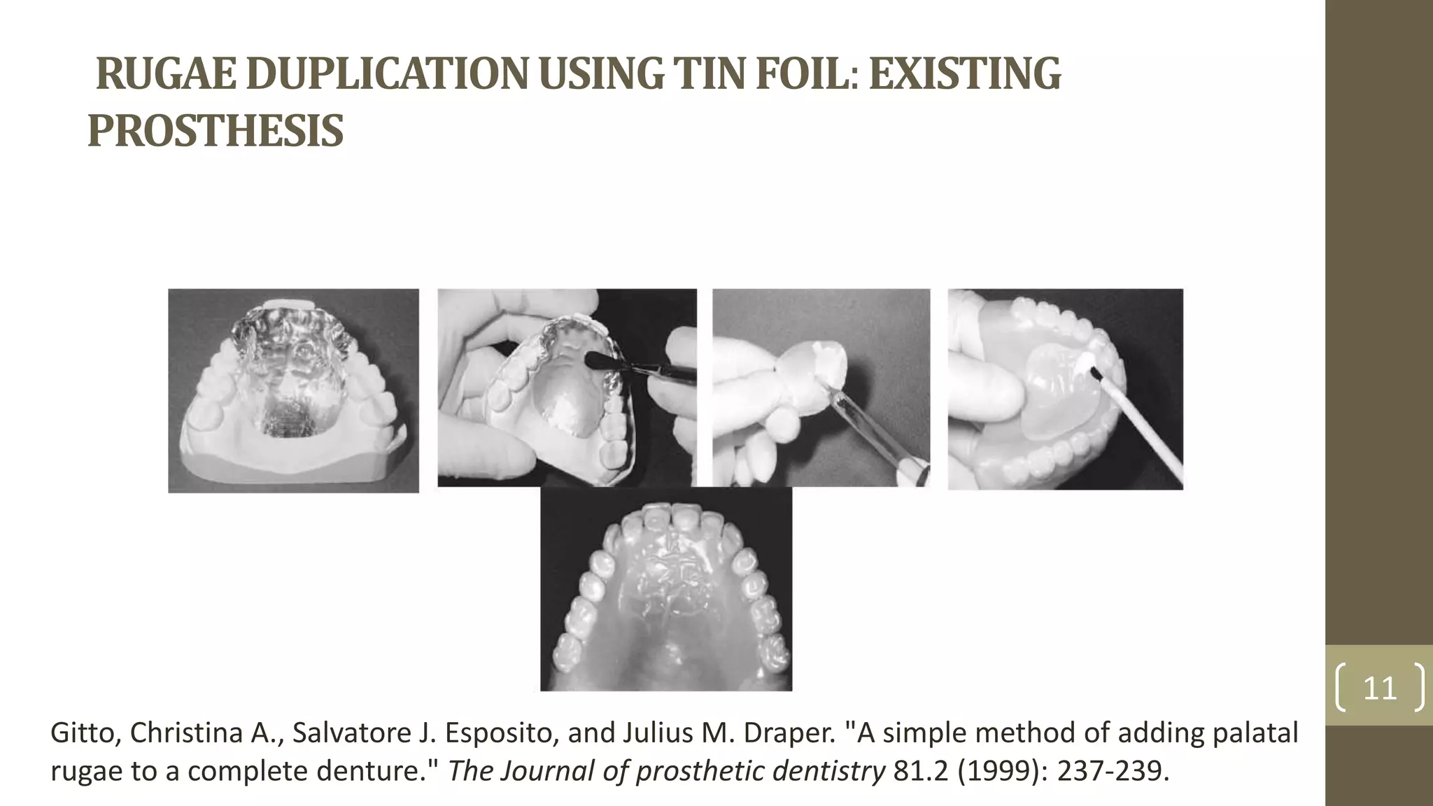Palatal contours of denture | PPTX