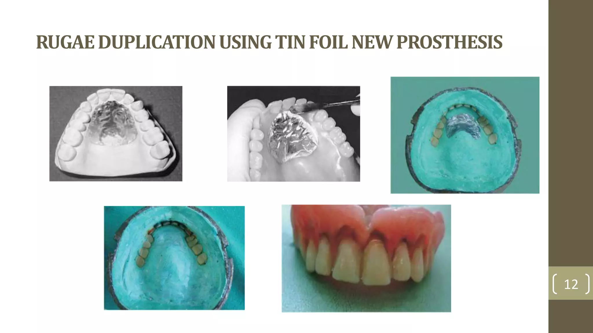 Palatal contours of denture | PPTX