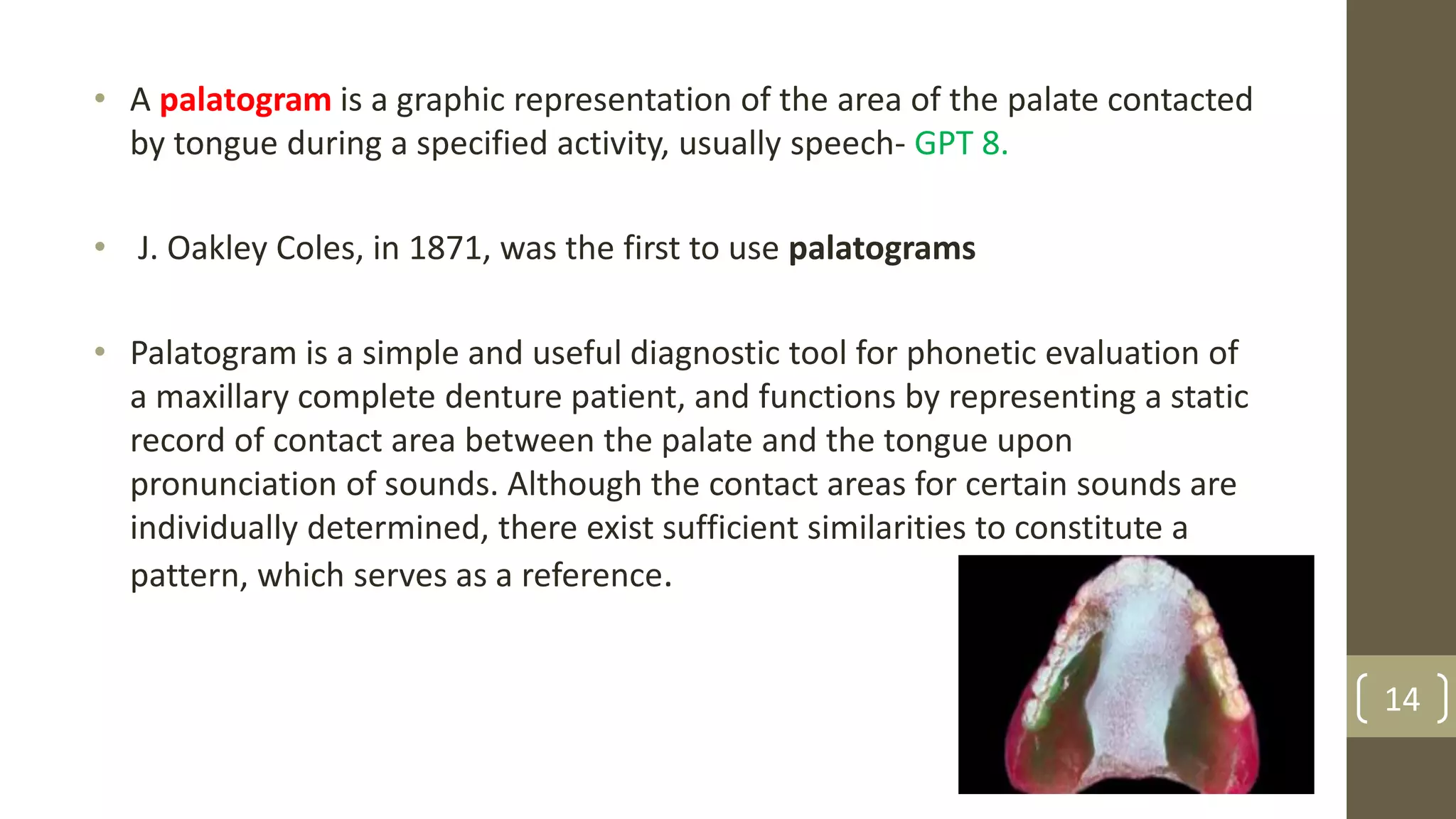 Palatal contours of denture | PPTX