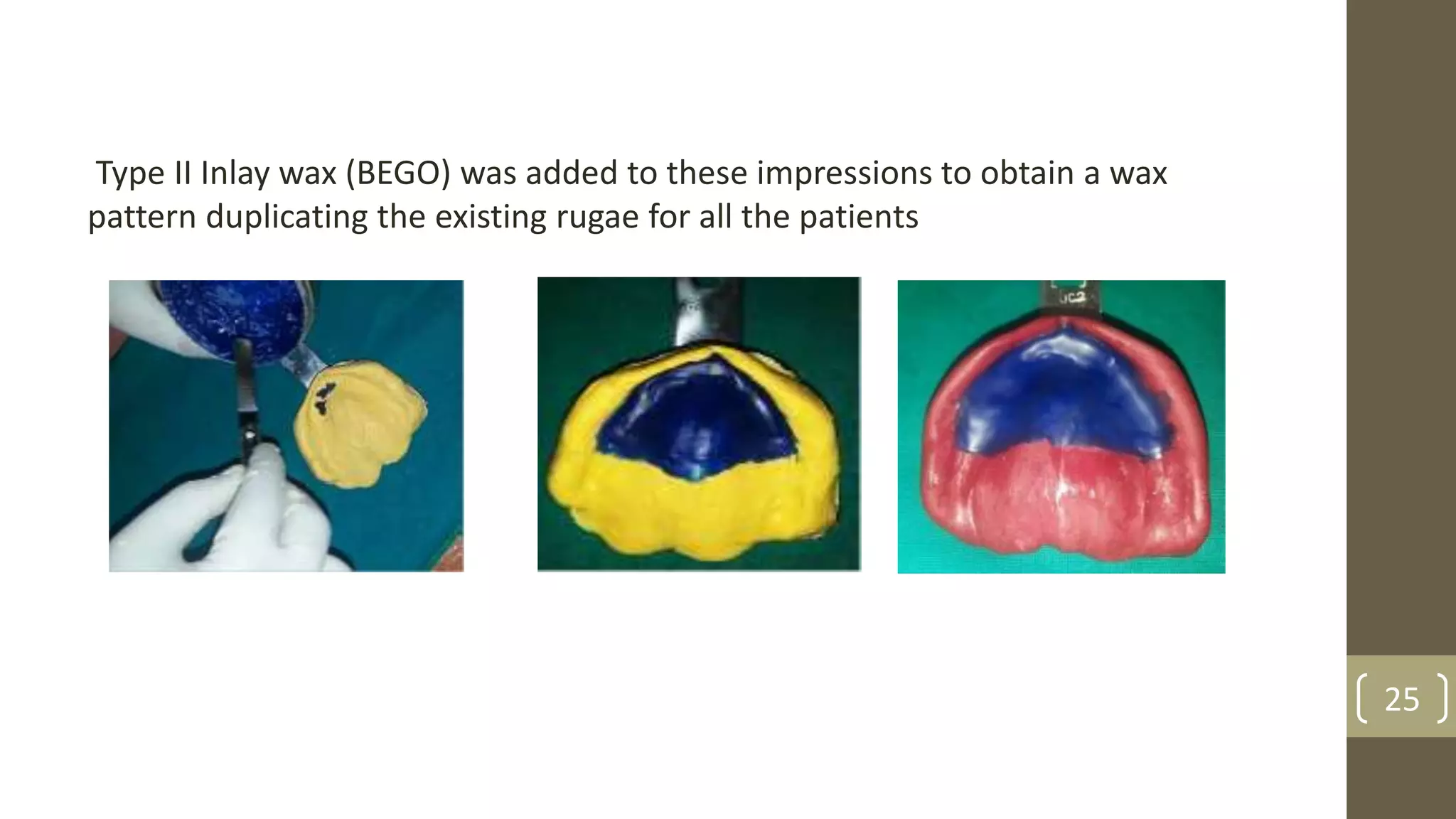 Palatal contours of denture | PPTX