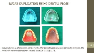 Palatal contours of denture | PPTX