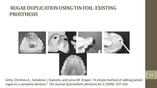 Palatal contours of denture | PPTX