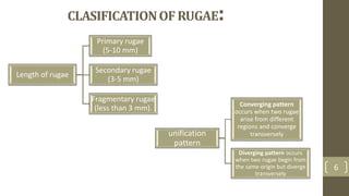 Palatal contours of denture | PPTX
