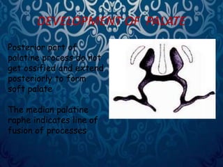 Palatal fistula and syndromes associated with clcp part 1 by Dr. Amit ...