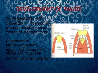 Palatal fistula and syndromes associated with clcp part 1 by Dr. Amit ...