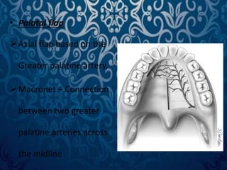 Palatal fistula and syndromes associated with clcp part ii by Dr. Amit ...