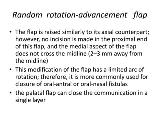 Palatal island flap | PPTX