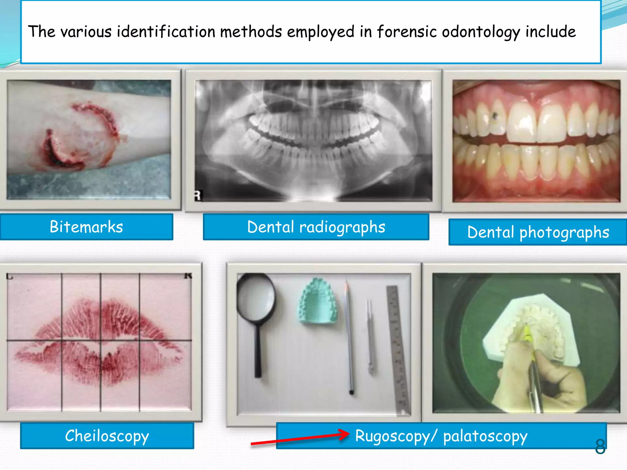 Palatal rugae as an aid for personnel identification | PPTX