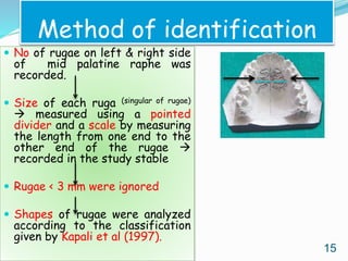 Palatal rugae as an aid for personnel identification | PPTX