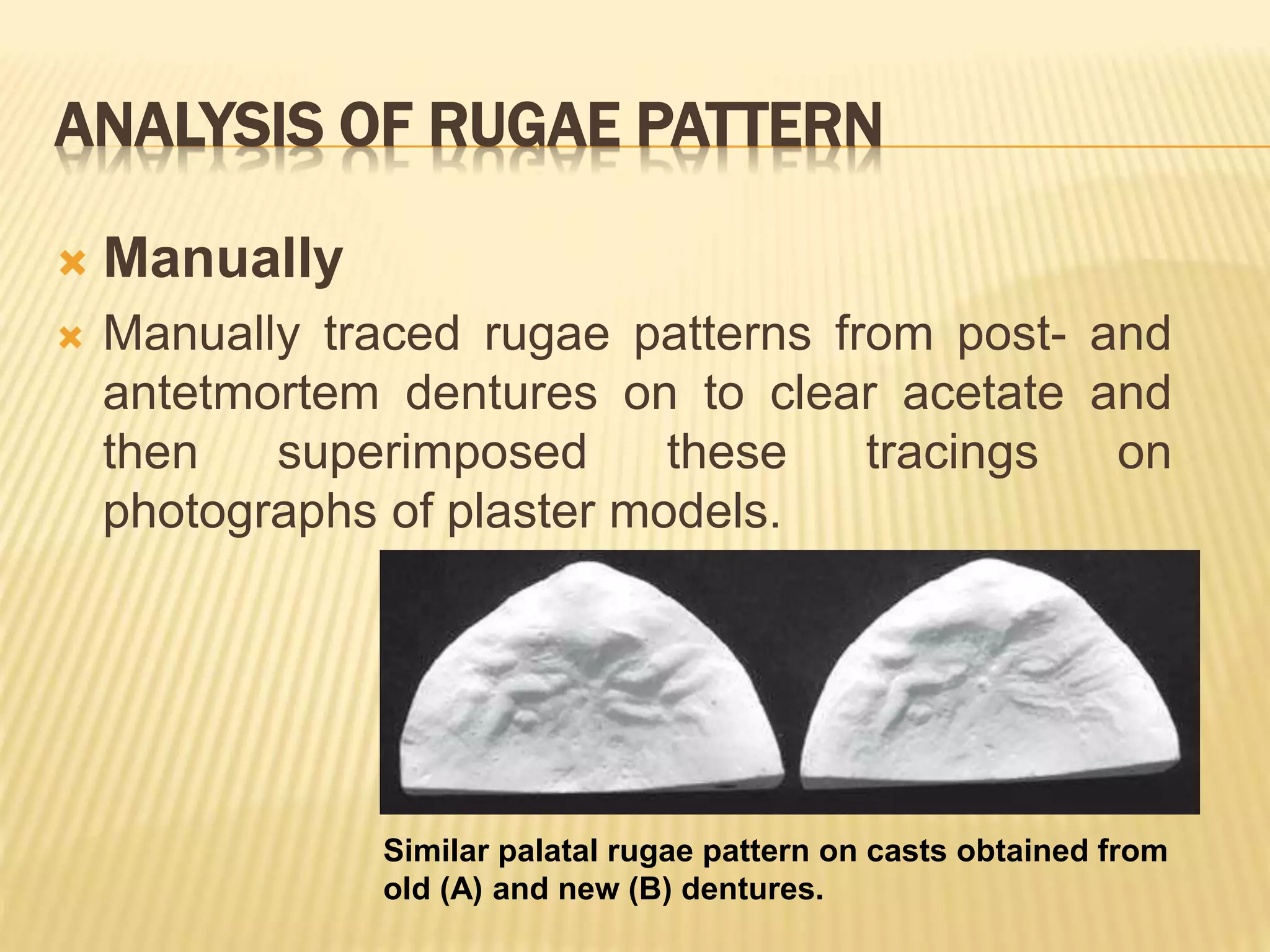 Palatal rugae | PPTX