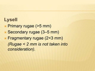 Palatal rugae | PPTX
