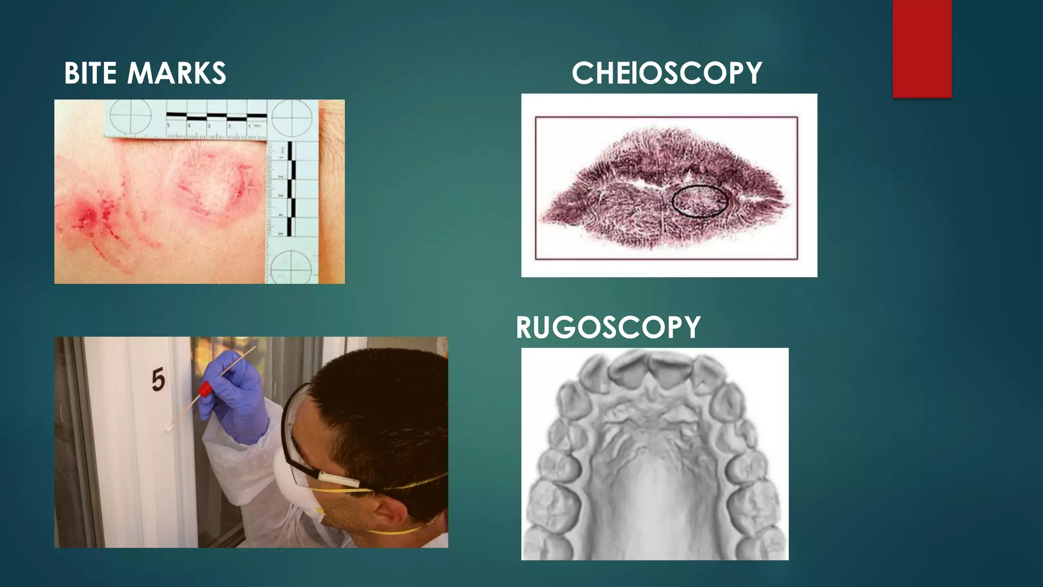 PALATAL RUGAE IN FORENSIC ODONTOLOGY | PDF