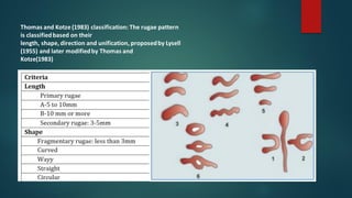 PALATAL RUGAE IN FORENSIC ODONTOLOGY | PDF