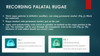 PALATAL RUGAE IN FORENSIC ODONTOLOGY | PDF