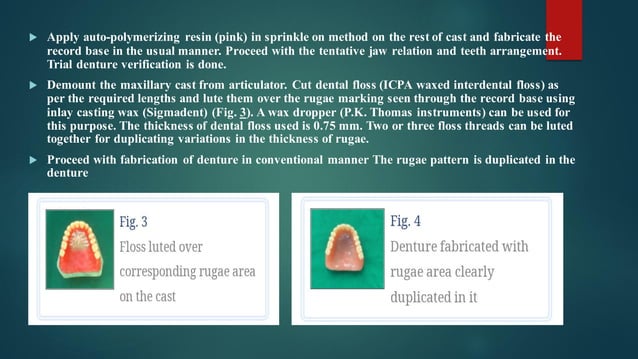 PALATAL RUGAE IN FORENSIC ODONTOLOGY | PDF | Oral care | Personal Care