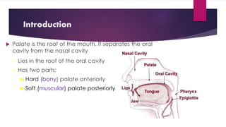 Palate , by dr.parthsarthi gautam, MDS | PPTX