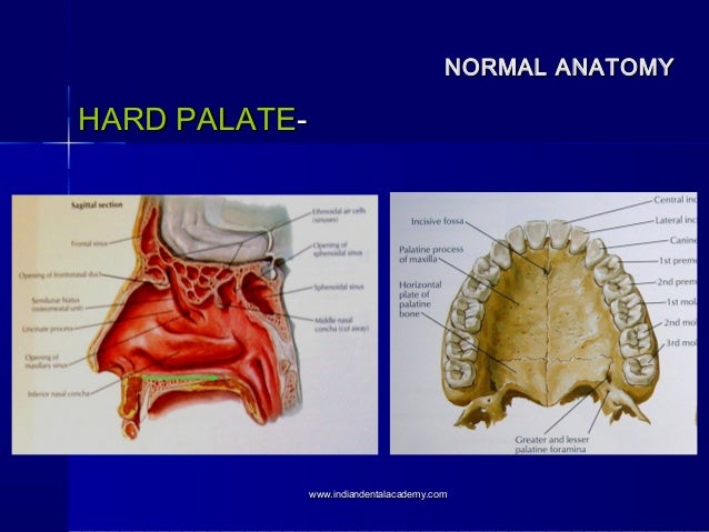Normal Soft Palate