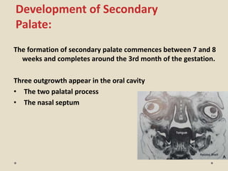 Palate PPT | PPTX