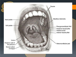 Palate.pptx