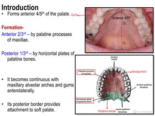 palate.pptx