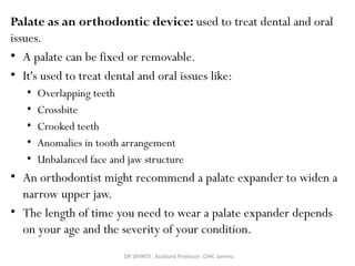 ANATOMY of HARD and SOFT PALATE. pptx | PPTX