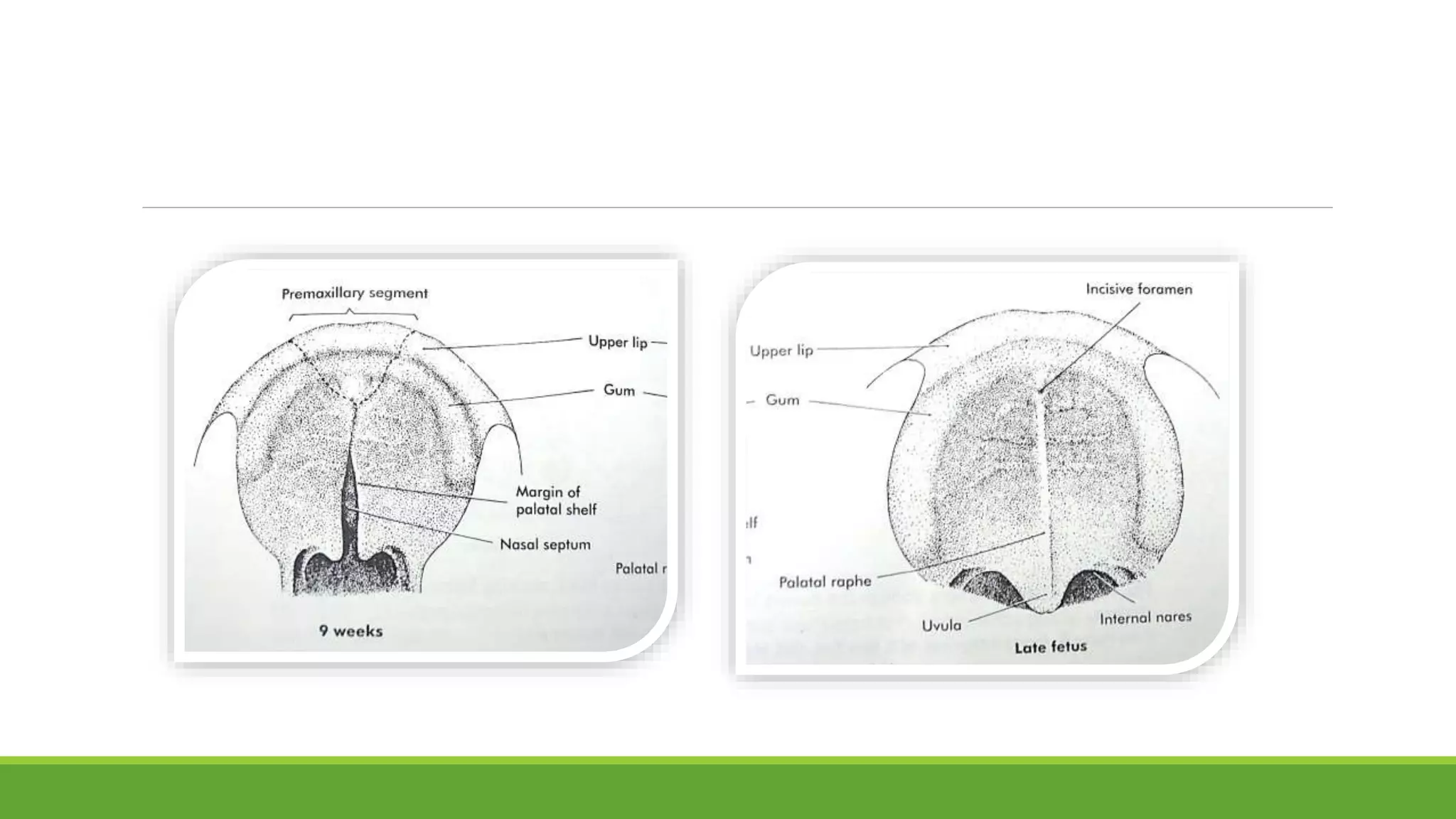 palate anatomy | PPTX