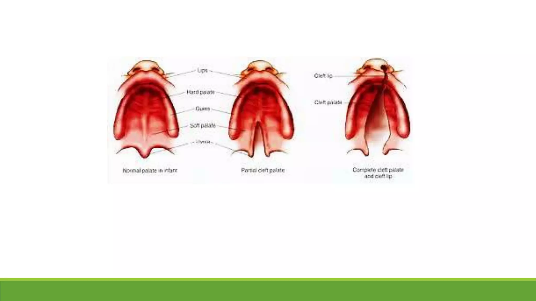 palate anatomy | PPTX