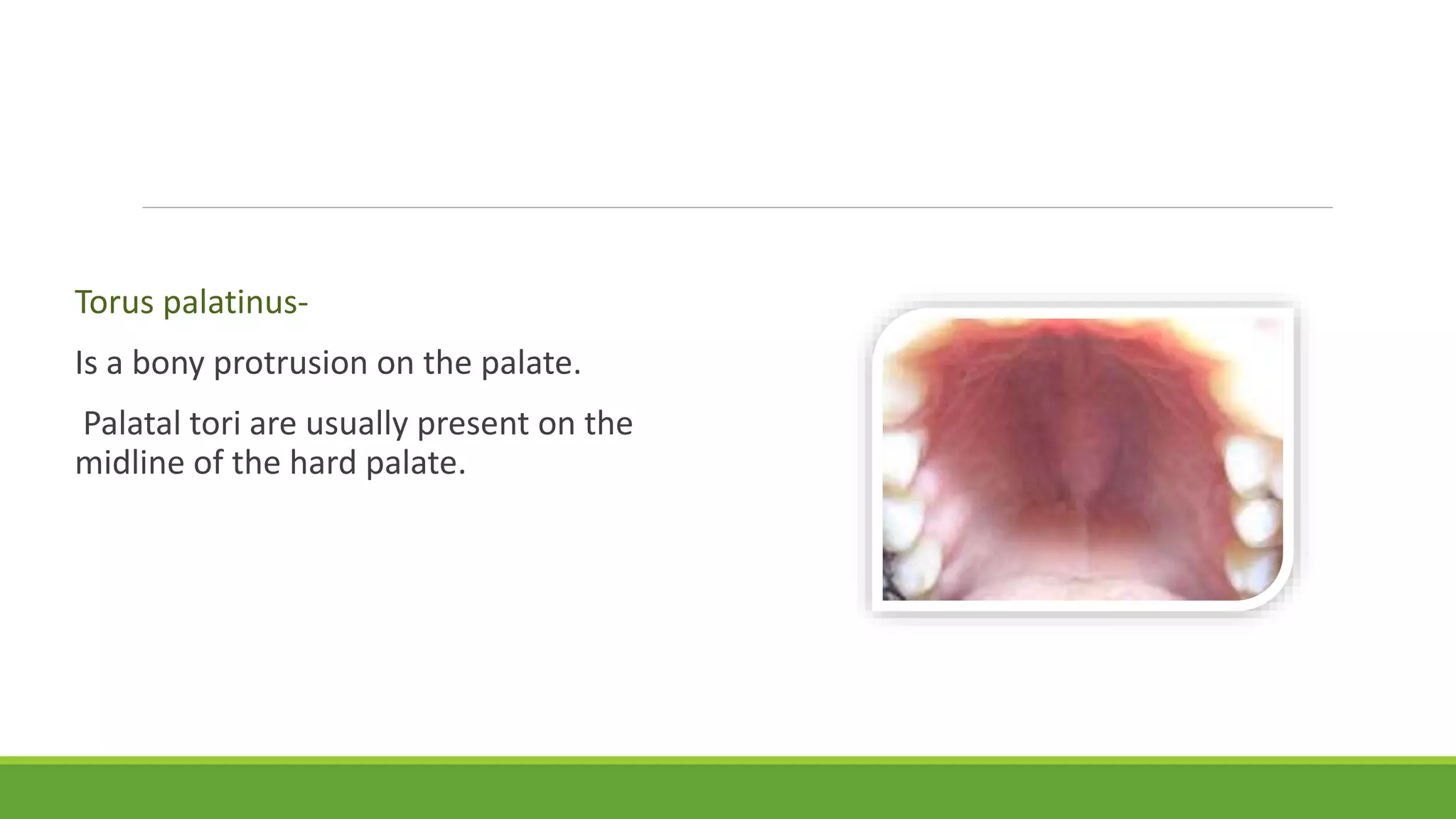 palate anatomy | PPTX
