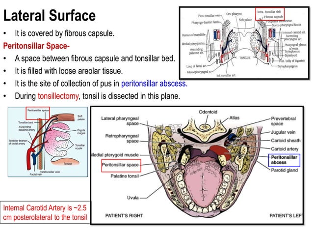 PALATINE-TONSILS Anatomy and applied aspectspresentation | PPT