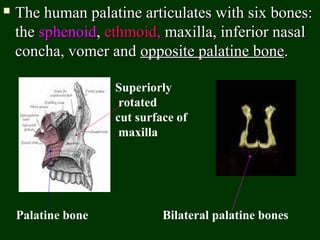 Palatine bone | PPT