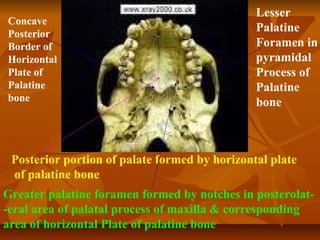 Palatal Process
