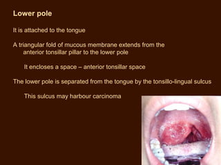 Palatine tonsil | PPT