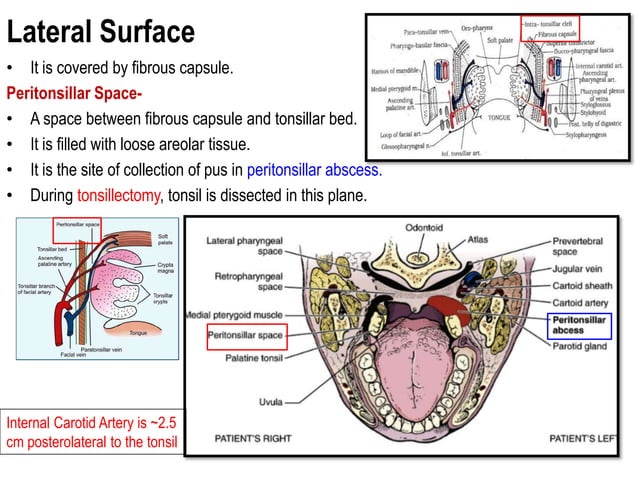 palatine_tonsils.pptx | Ear, Nose and Throat Conditions | Diseases and ...